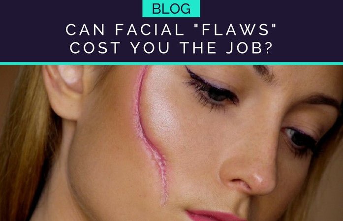 Birthmarks, Scars and Other Facial "Flaws" May Make it Harder to Land ...