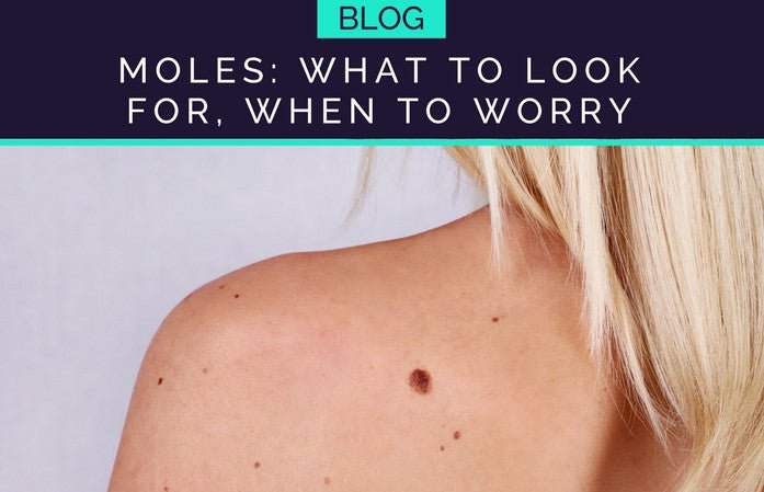 CHECKING YOUR MOLES: WHAT TO LOOK FOR – HueVine Wellness + Spa