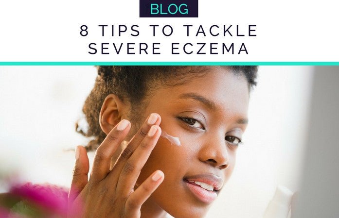 SEVERE ECZEMA + HOW TO TACKLE IT – HueVine Wellness + Spa